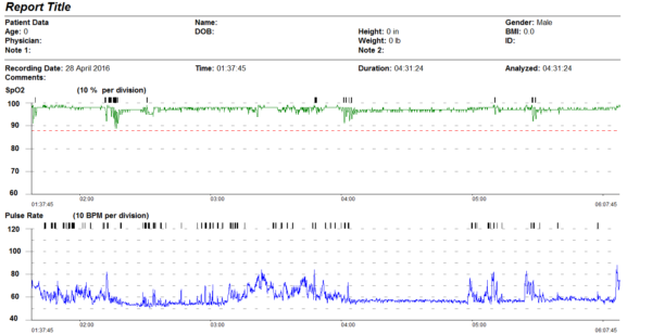 Overnight Oximetry Screening - HOMECARE MEDICAL