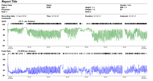 Overnight Oximetry Screening - HOMECARE MEDICAL